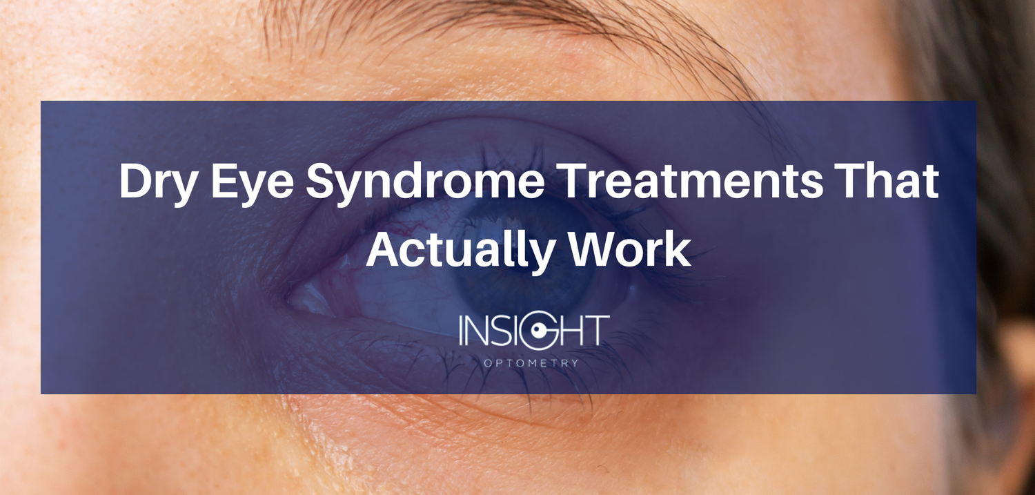 Dry Eye Syndrome Treatments That Actually Work – Insight Optometry